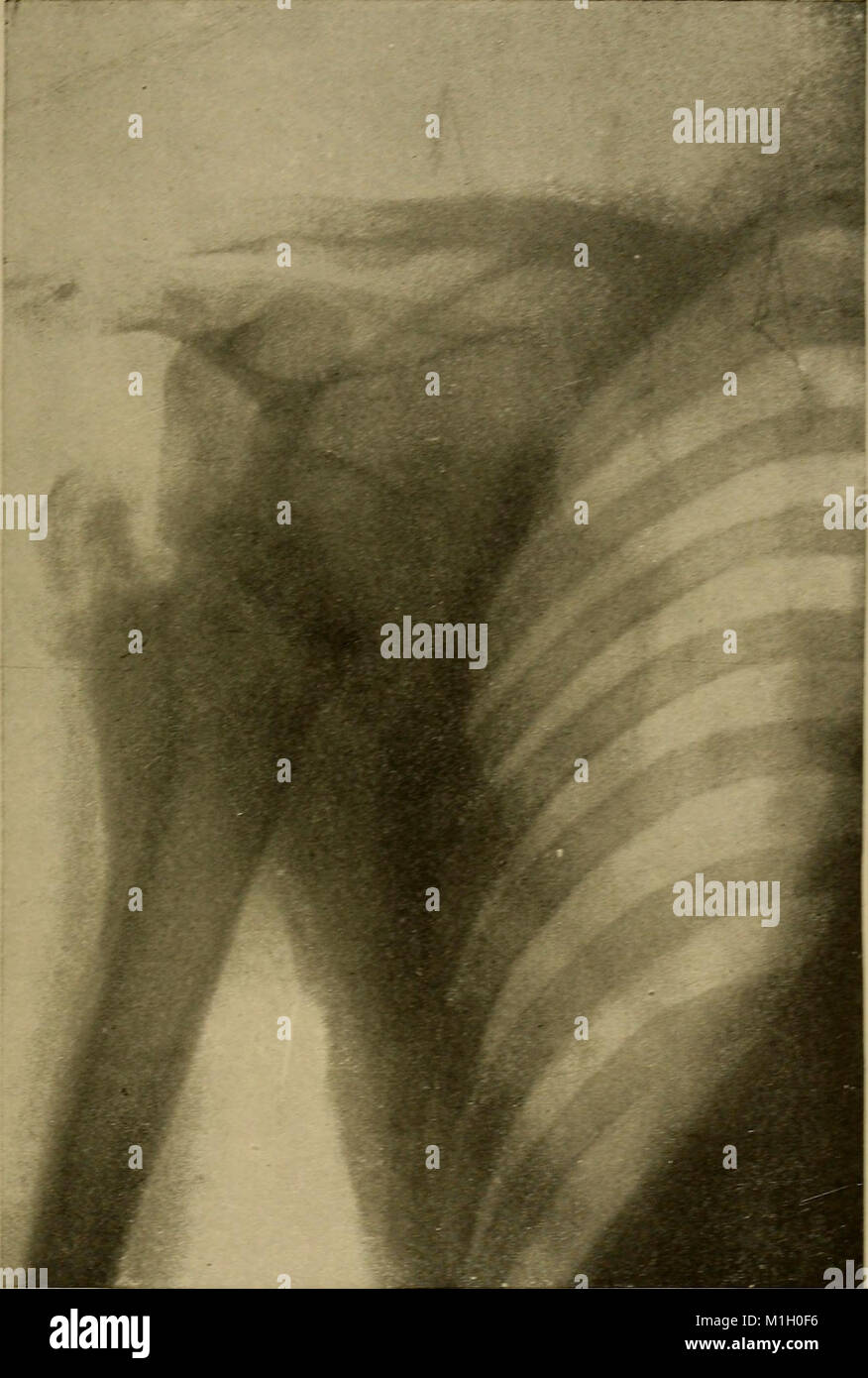 A system of instruction in X-ray methods and medical uses of light, hot ...