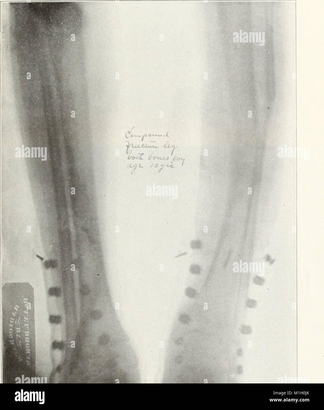 The *American X-ray Journal* (1897) covers advancements in X-ray ...