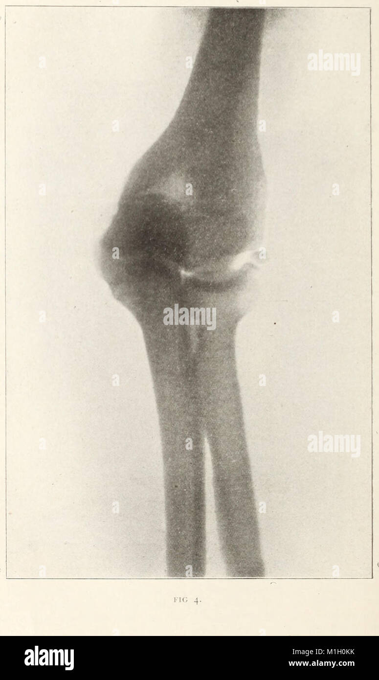 The 1897 American X-ray Journal focuses on advancements in X-ray ...