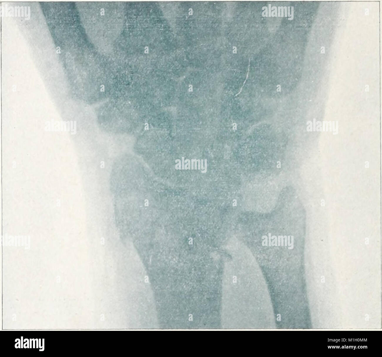 The American X-ray Journal (1897) covers advancements in the use of X ...