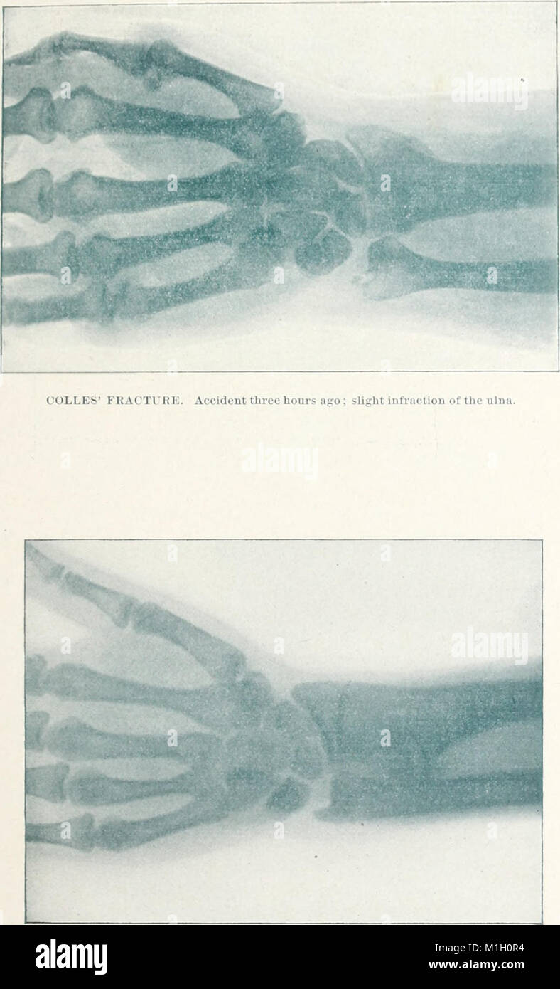 Journal radiology case no hi-res stock photography and images - Alamy