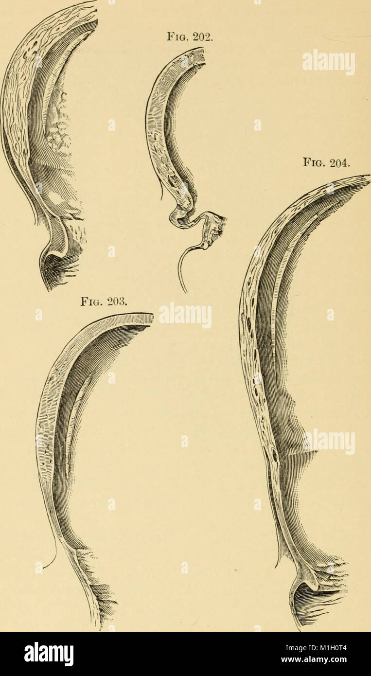 A system of obstetrics (1888) (14592481297 Stock Photo - Alamy