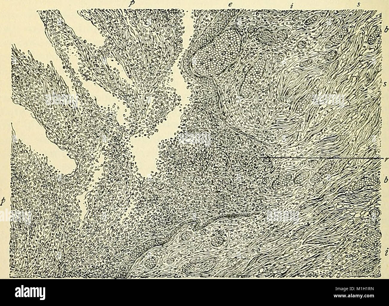 An American text-book of genito-urinary diseases, syphilis and diseases ...