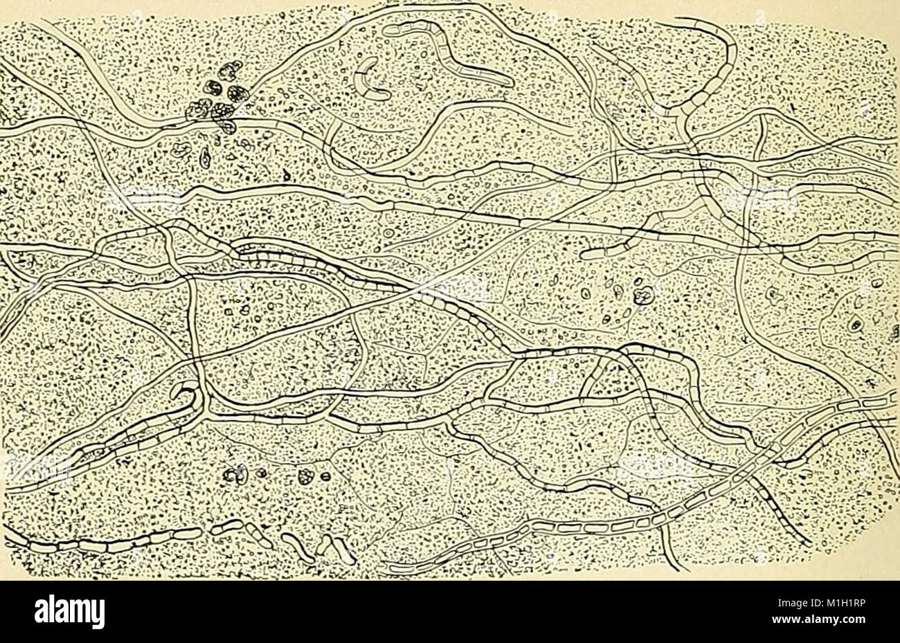 An American text-book of genito-urinary diseases, syphilis and diseases ...