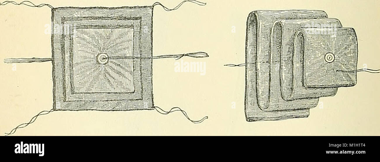 An American text-book of genito-urinary diseases, syphilis and diseases ...