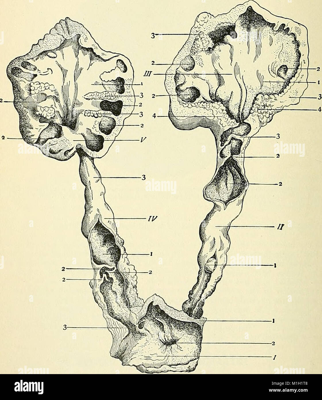 An American text-book of genito-urinary diseases, syphilis and diseases ...