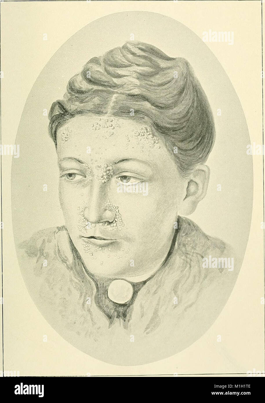 This 1898 textbook covers the diagnosis and treatment of genito-urinary ...