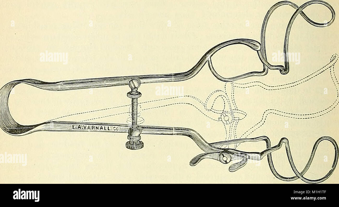 Syphilis historical hi-res stock photography and images - Alamy
