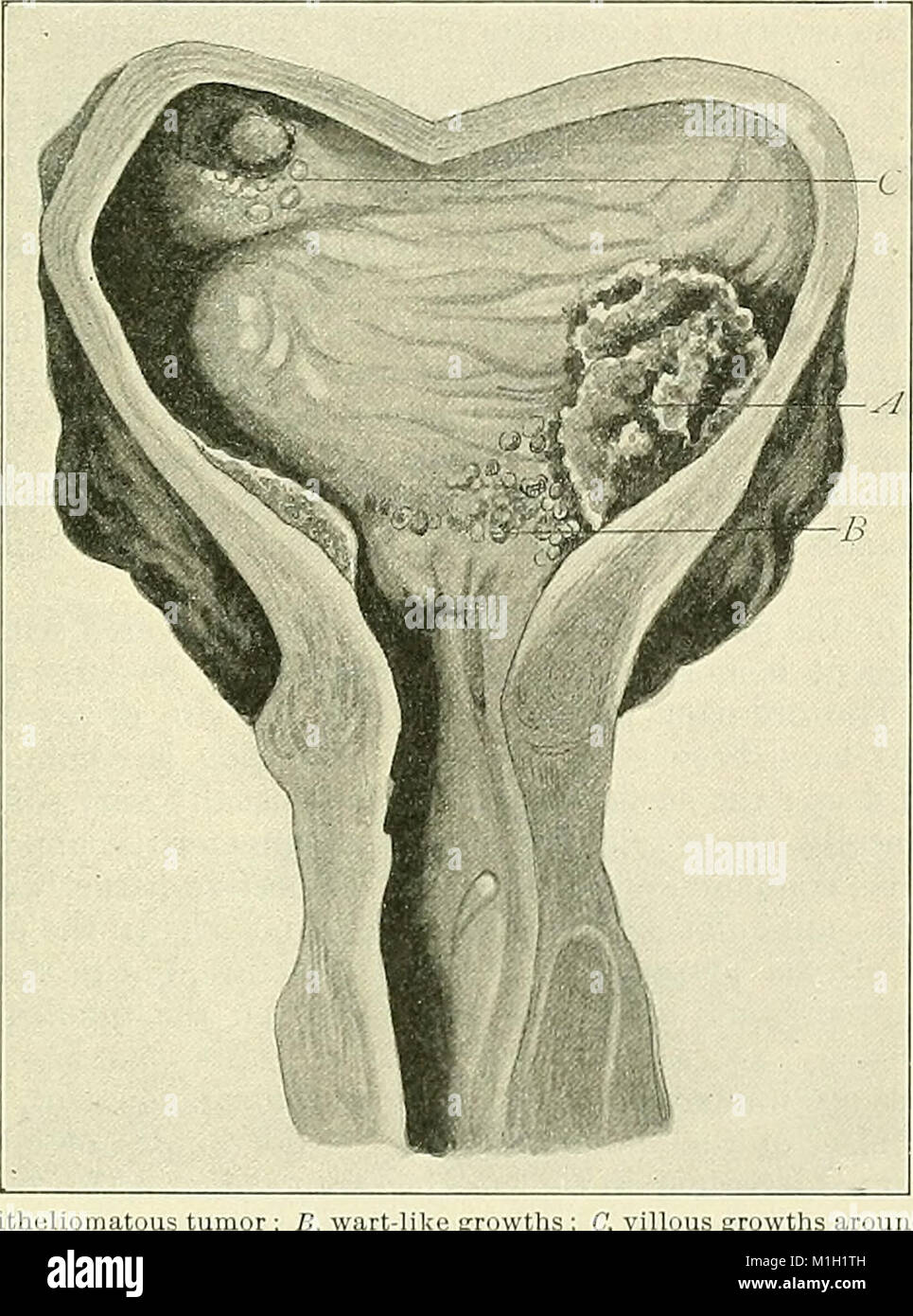 An American text-book of genito-urinary diseases, syphilis and diseases ...
