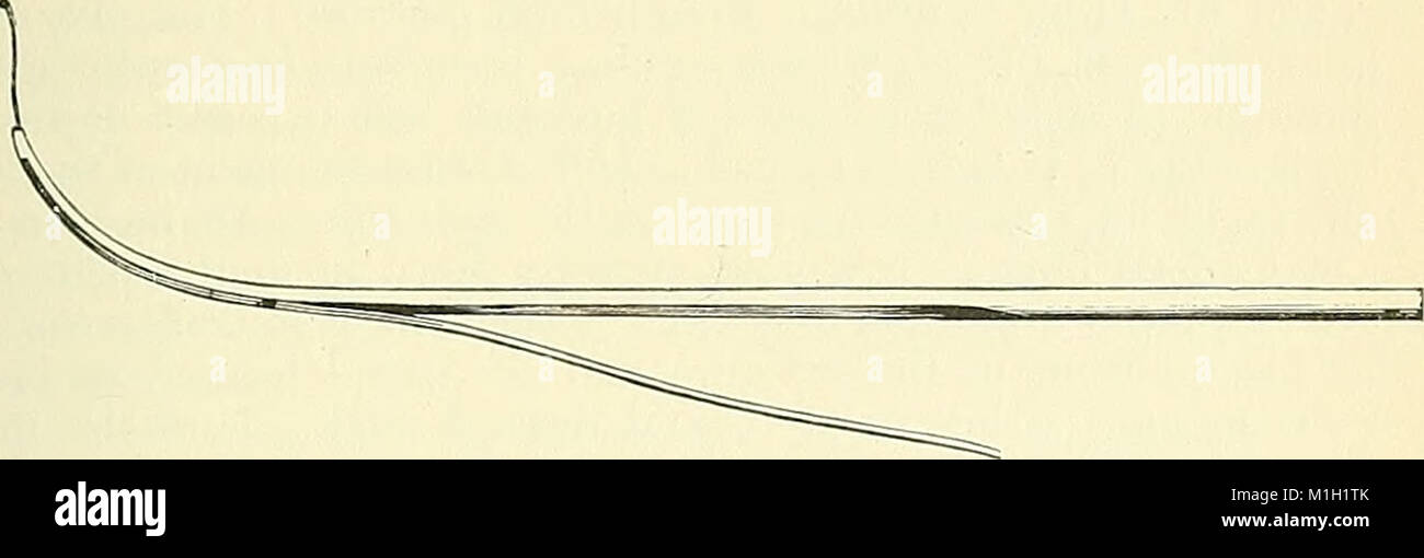 An American text-book of genito-urinary diseases, syphilis and diseases ...