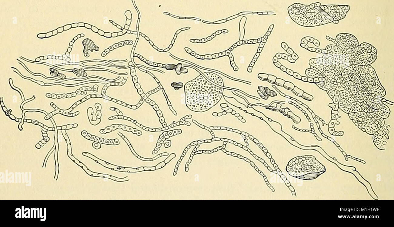 An American text-book of genito-urinary diseases, syphilis and diseases ...