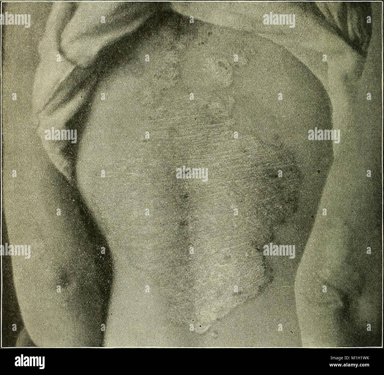 This 1898 textbook provides comprehensive medical information on genito ...