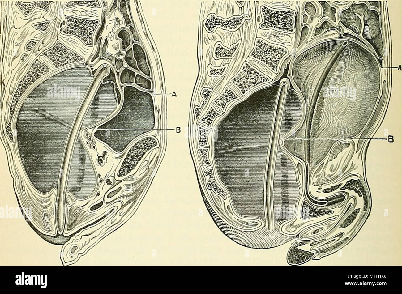 An American text-book of genito-urinary diseases, syphilis and diseases ...