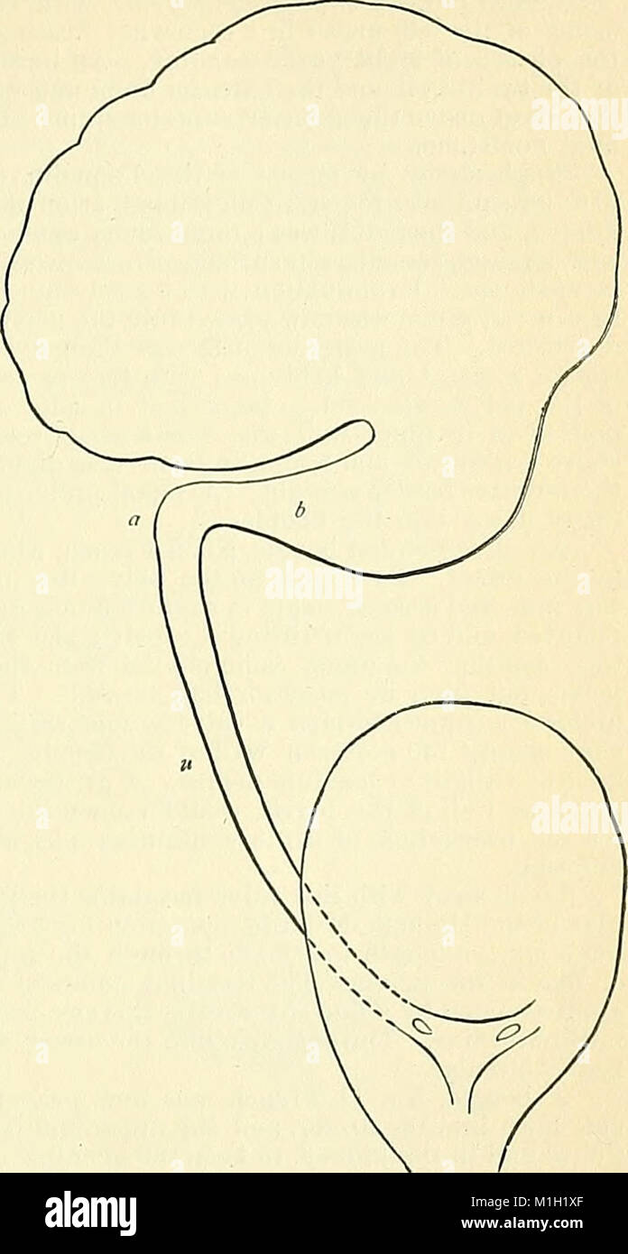 An American text-book of genito-urinary diseases, syphilis and diseases ...