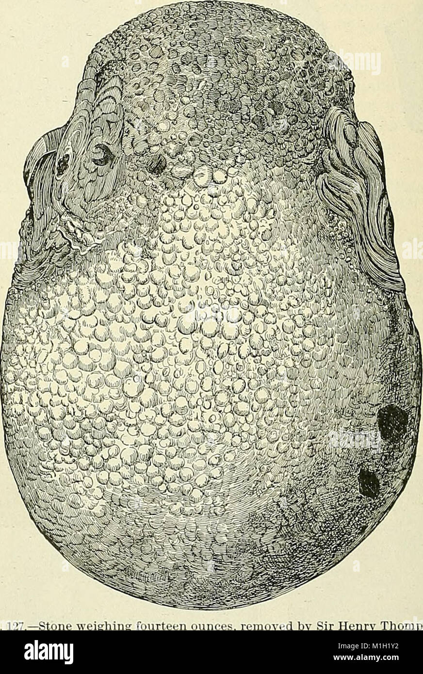 An American text-book of genito-urinary diseases, syphilis and diseases ...