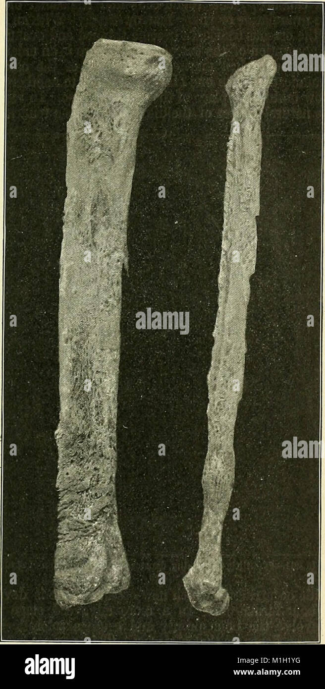 An American text-book of genito-urinary diseases, syphilis and diseases ...