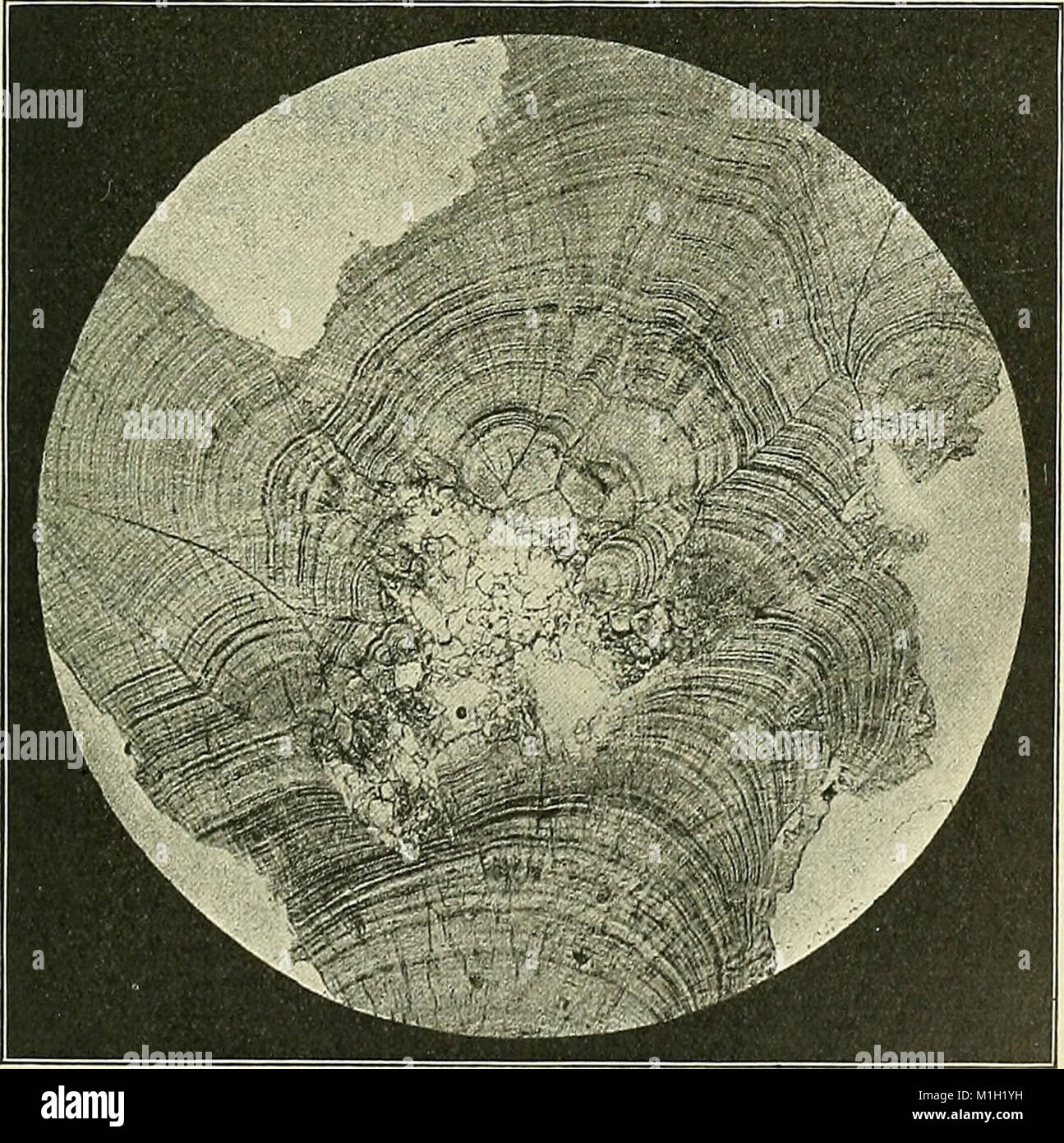 This 1898 textbook provides a comprehensive guide to genito-urinary ...