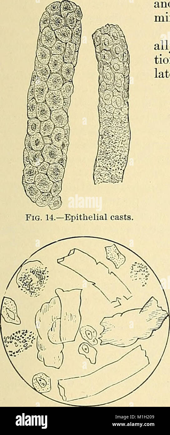 An American text-book of genito-urinary diseases, syphilis and diseases ...