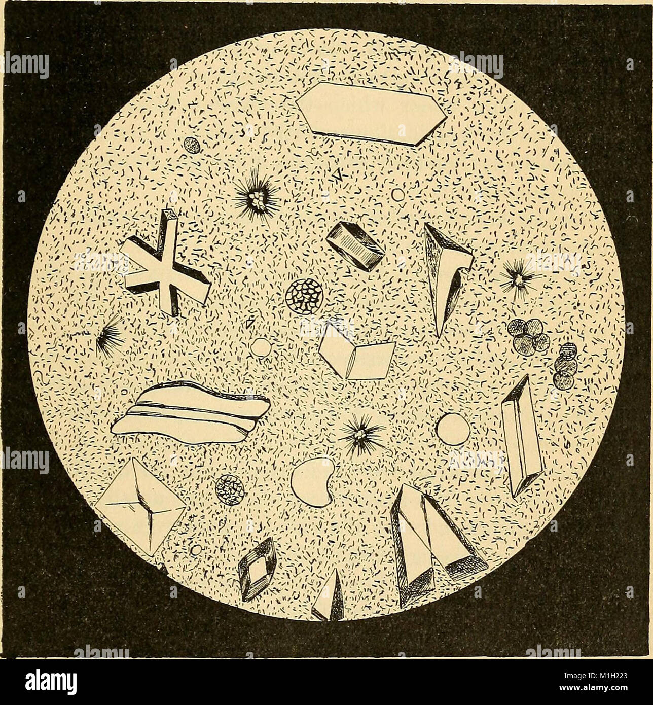 A system of genito-urinary diseases, syphilology and dermatology (1893 ...