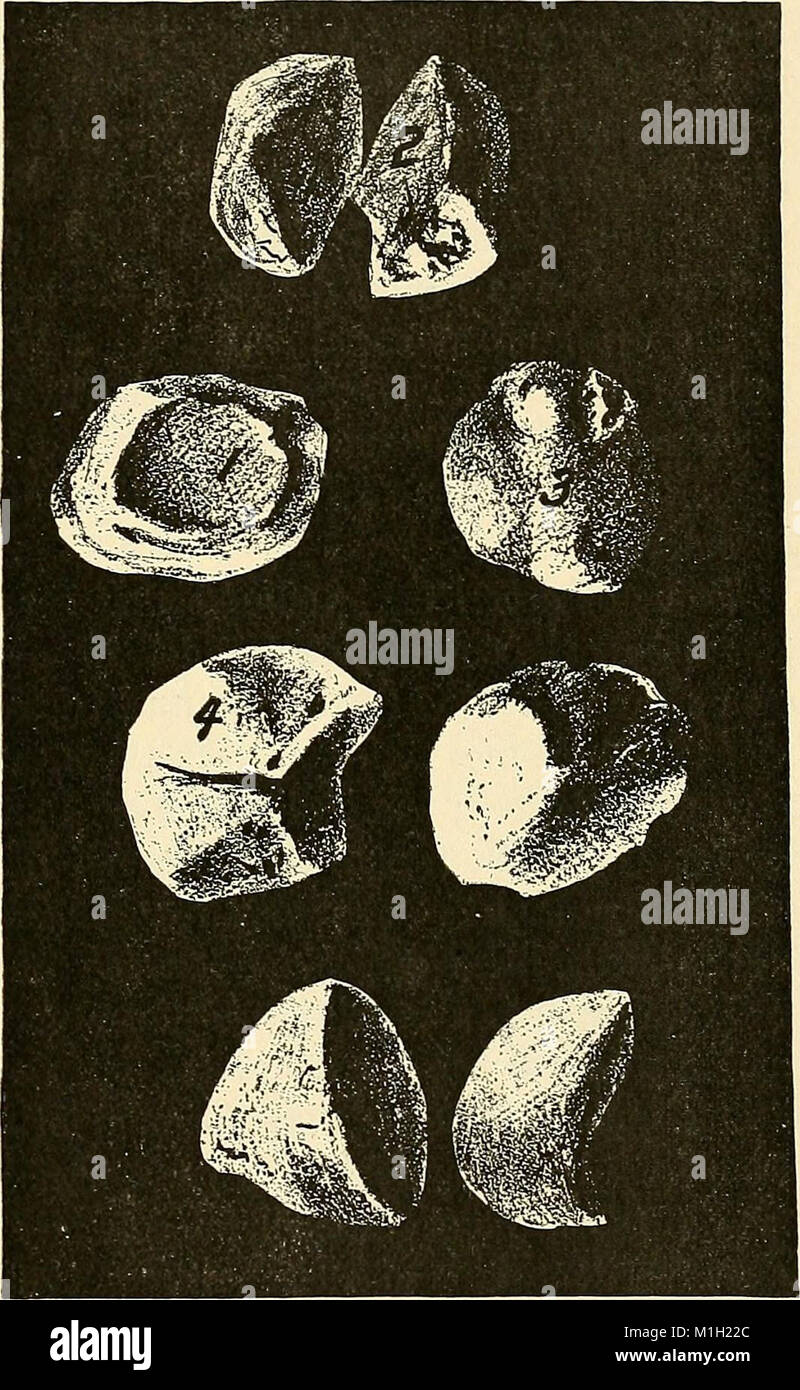 A system of genito-urinary diseases, syphilology and dermatology (1893 ...