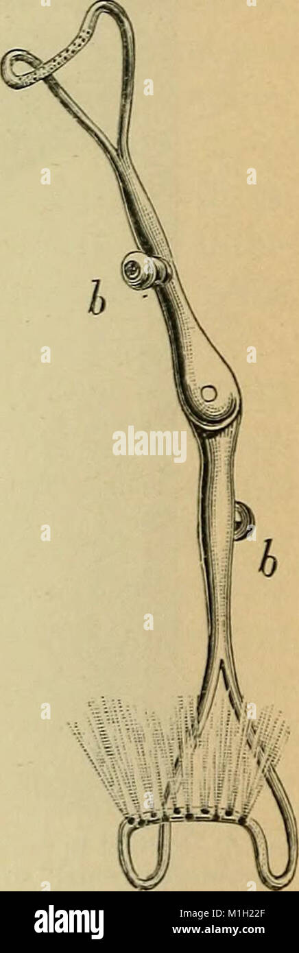 A system of genito-urinary diseases, syphilology and dermatology (1893 ...