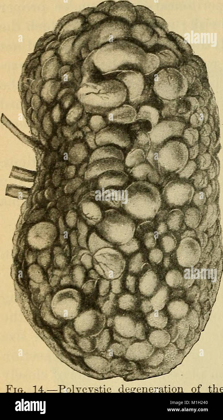 This 1893 medical reference covers genito-urinary diseases, syphilology ...