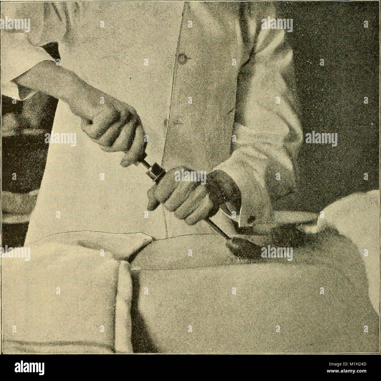 A system of genito-urinary diseases, syphilology and dermatology (1893 ...