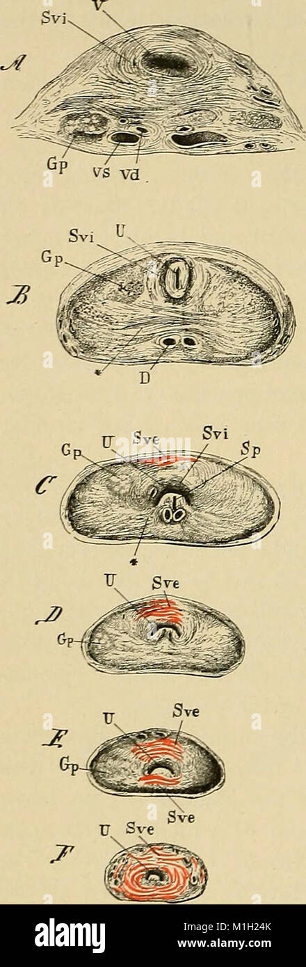 A system of genito-urinary diseases, syphilology and dermatology (1893 ...
