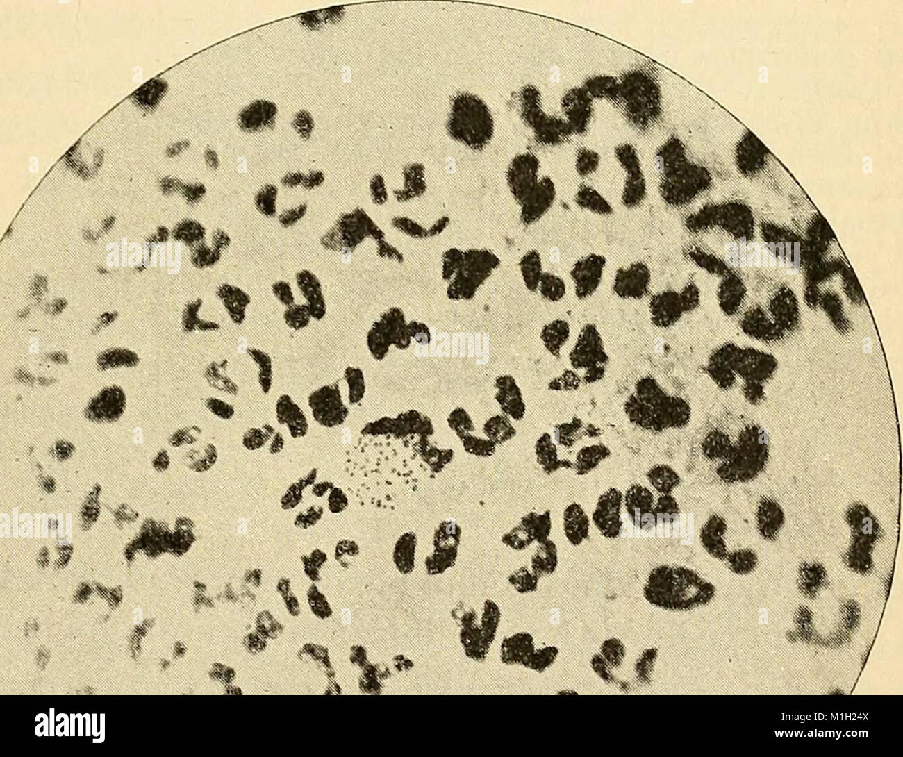 This 1893 work provides a detailed study on genito-urinary diseases ...