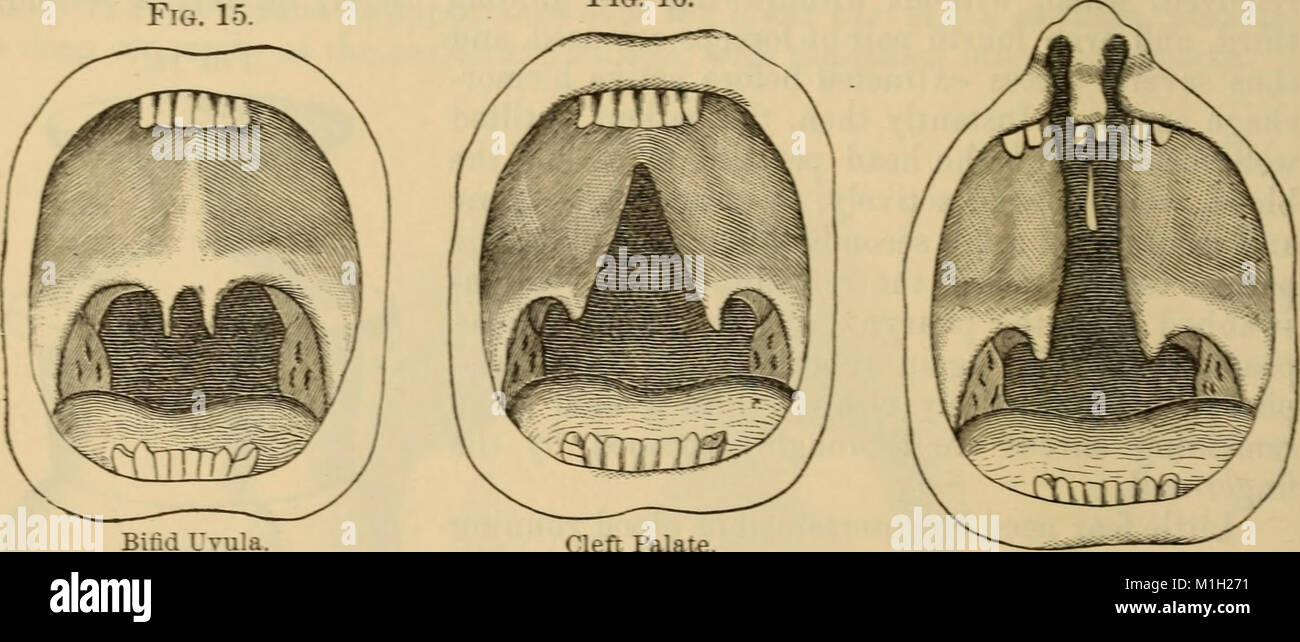 This 1895 text provides comprehensive medical knowledge on the diseases ...