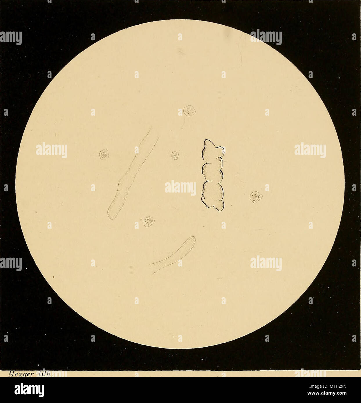 The 1885 Atlas of Clinical Microscopy provides detailed illustrations ...
