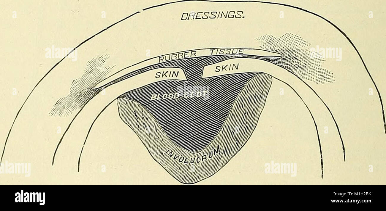 *A Manual of Modern Surgery* (1899) outlines the established surgical ...