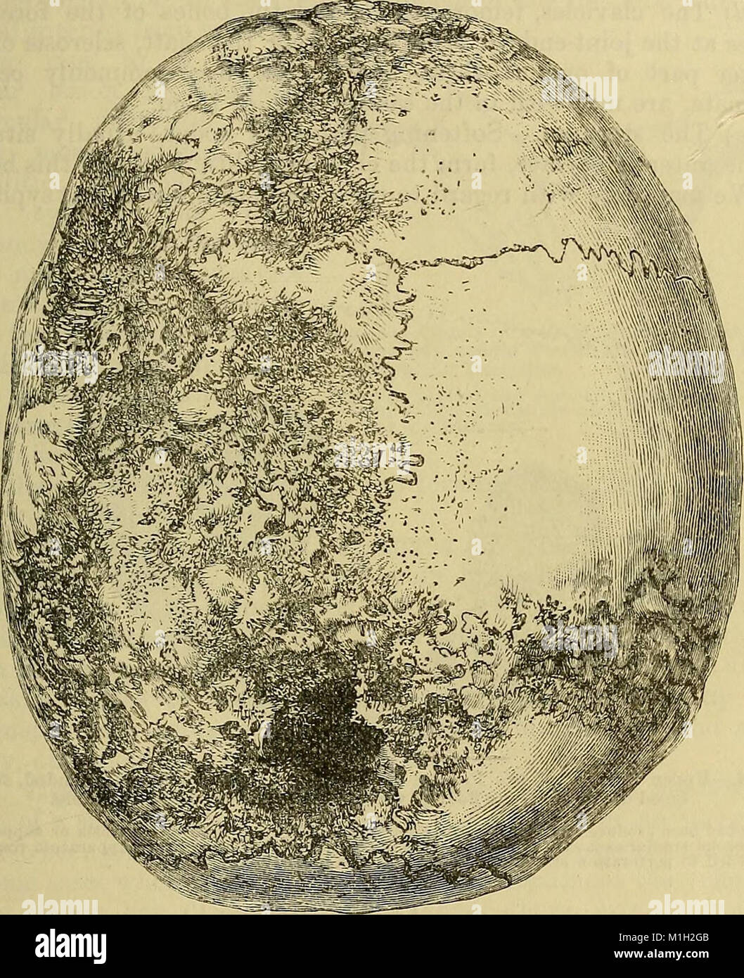 A System of Surgery (1895) provides a comprehensive overview of ...