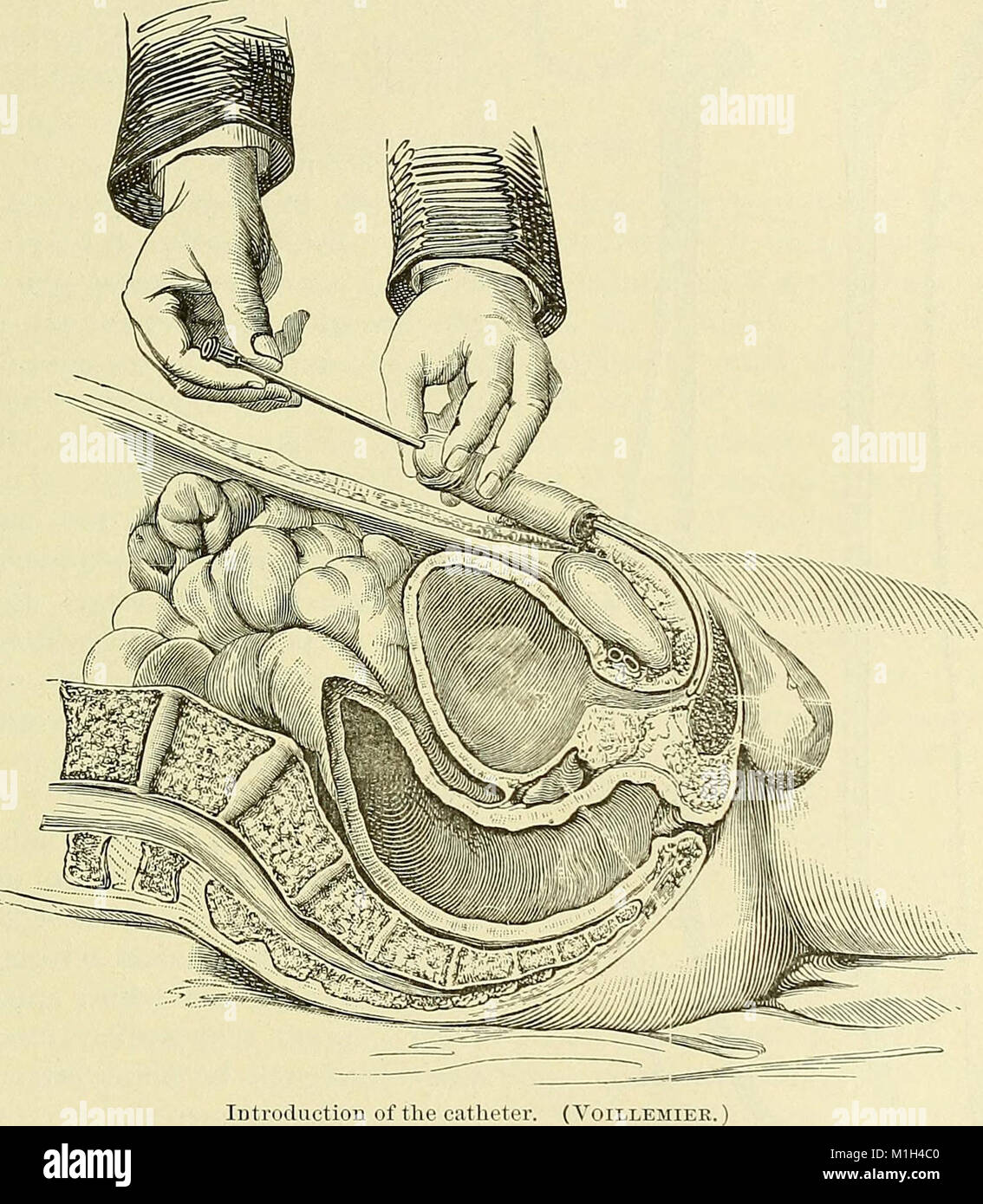 This 1899 manual presents modern surgical techniques, doctrines, and ...