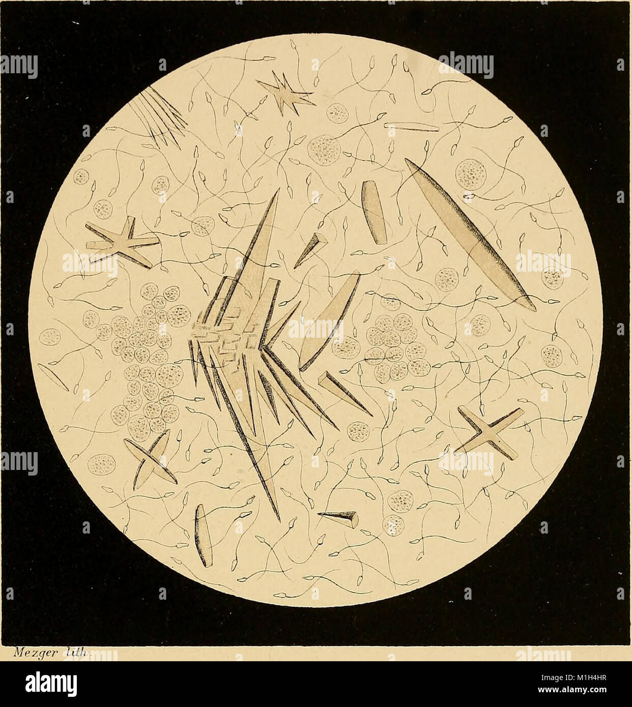'An Atlas of Clinical Microscopy' (1885) provides detailed ...