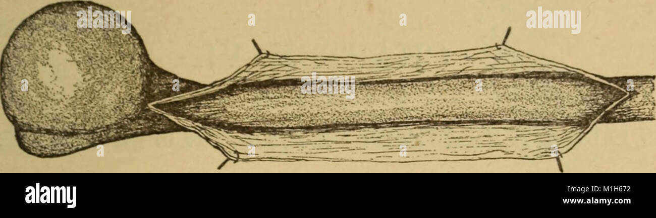 This 1889 educational textbook provides an overview of human anatomy ...