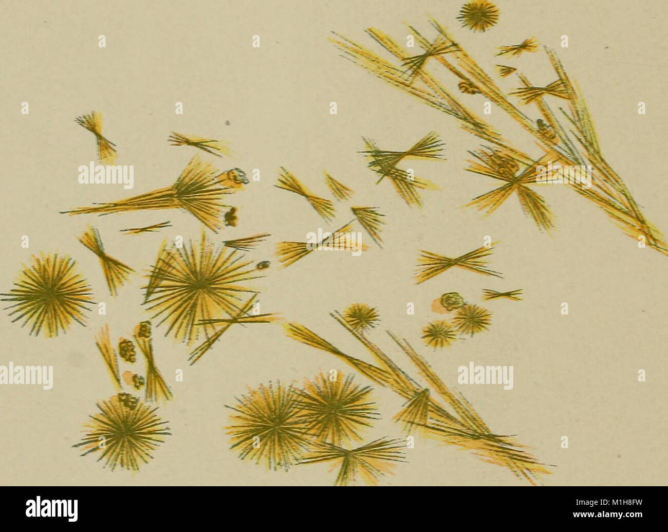 A manual of clinical diagnosis by means of microscopical and chemical ...