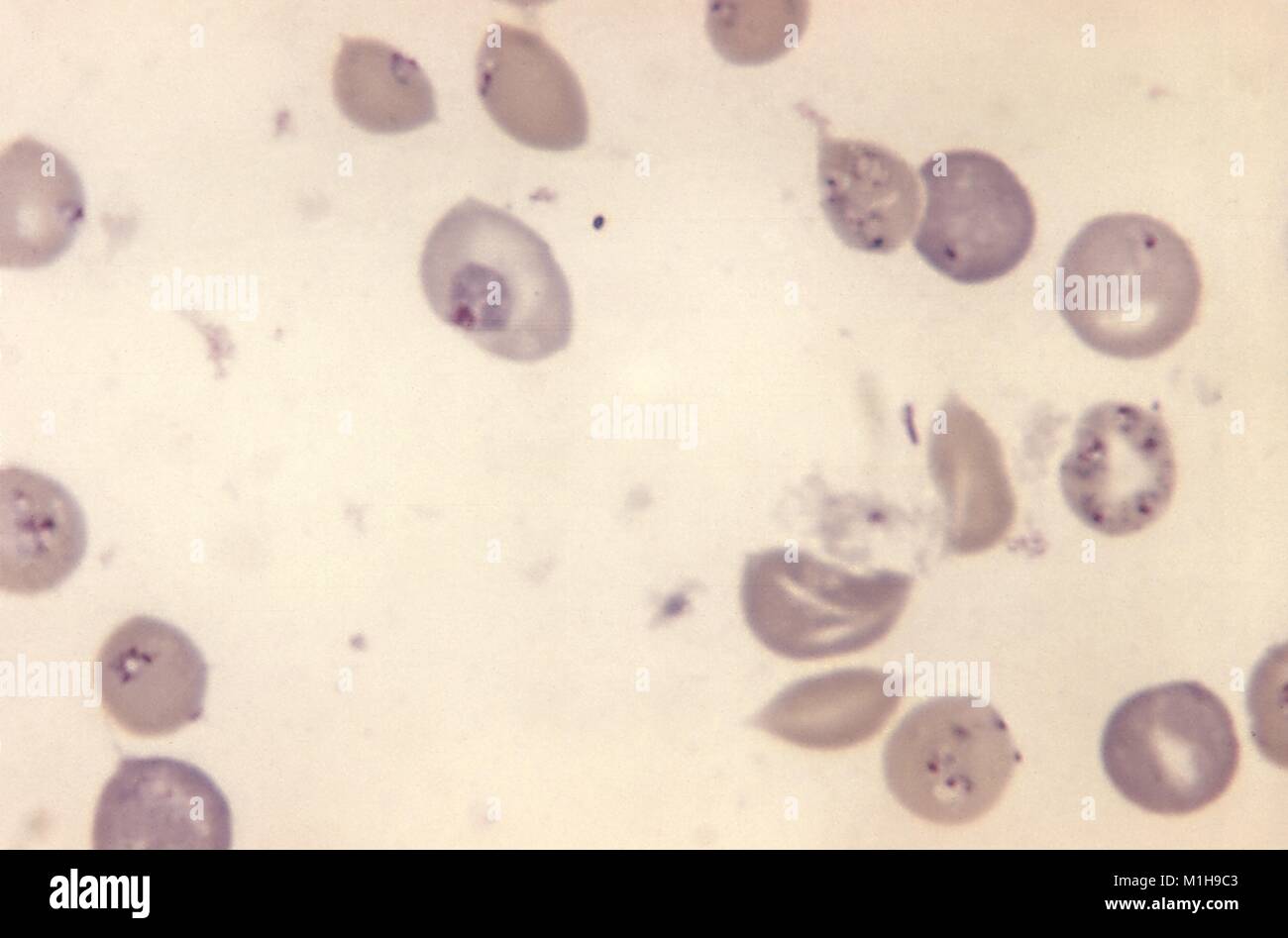 Babesia microti and Plasmodium berghei revealed in red blood cells ...