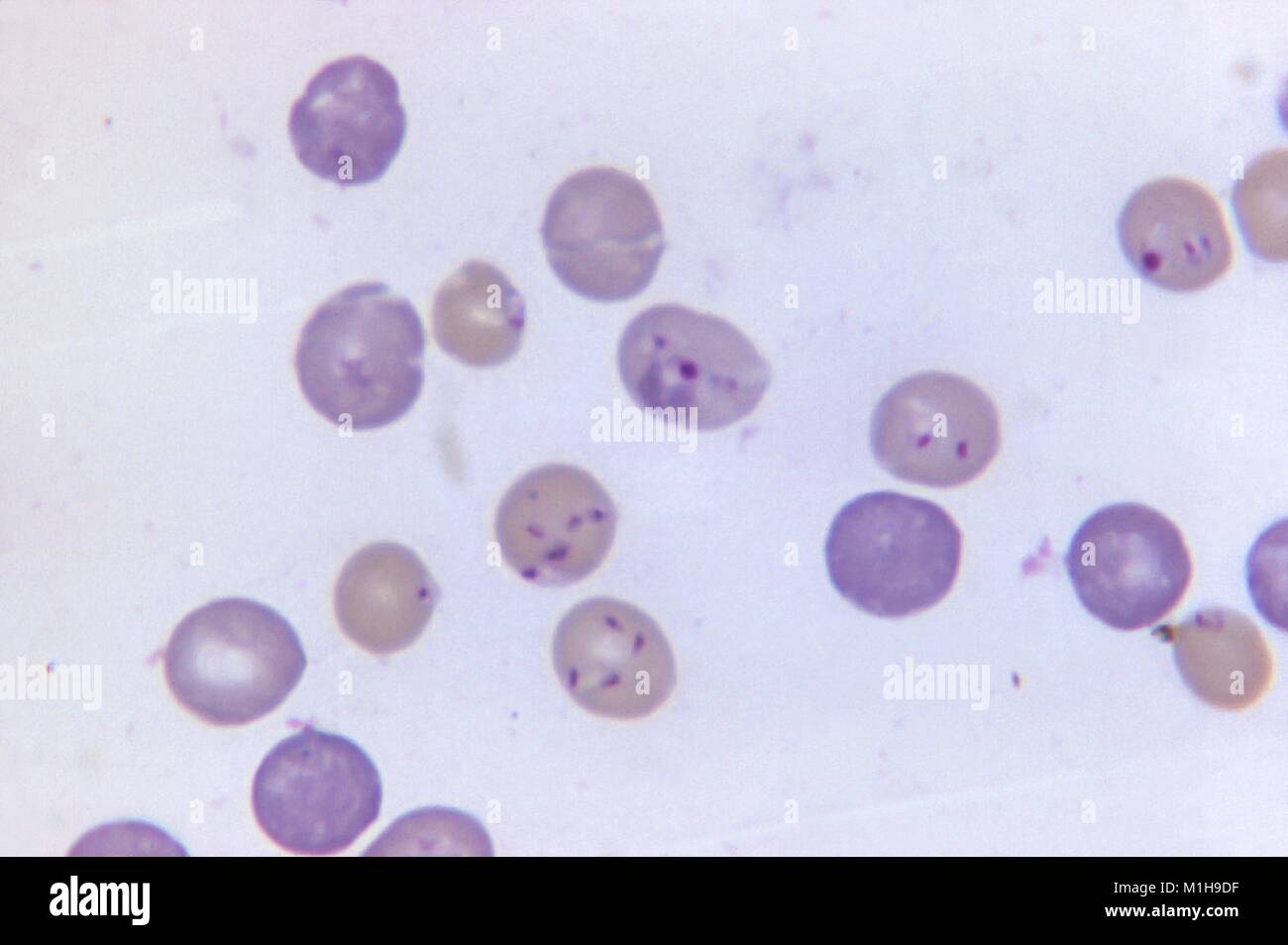 Babesia microti and Plasmodium berghei revealed in red blood cells ...