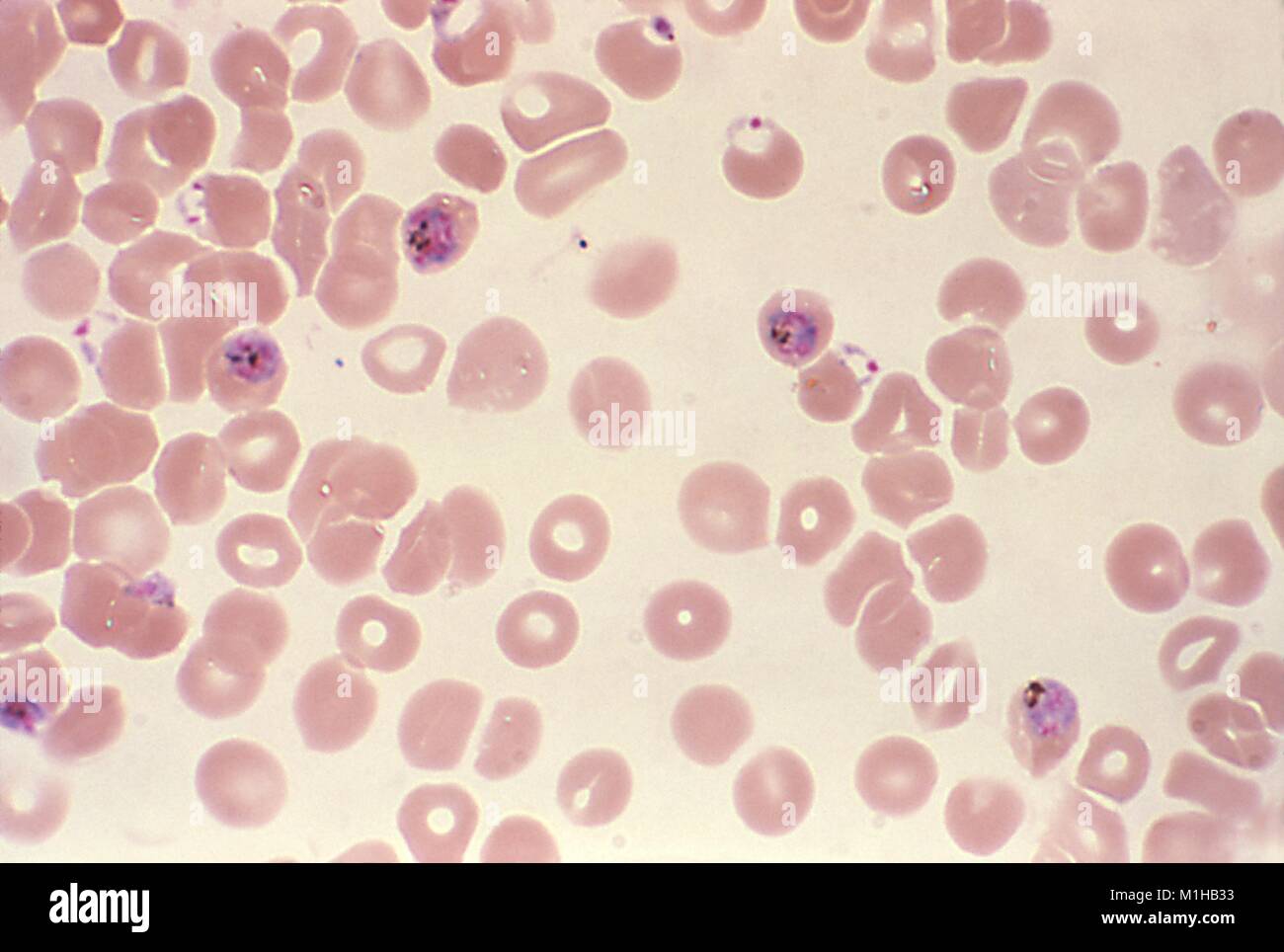 Plasmodium falciparum parasites after 24hrs of incubation found in a ...