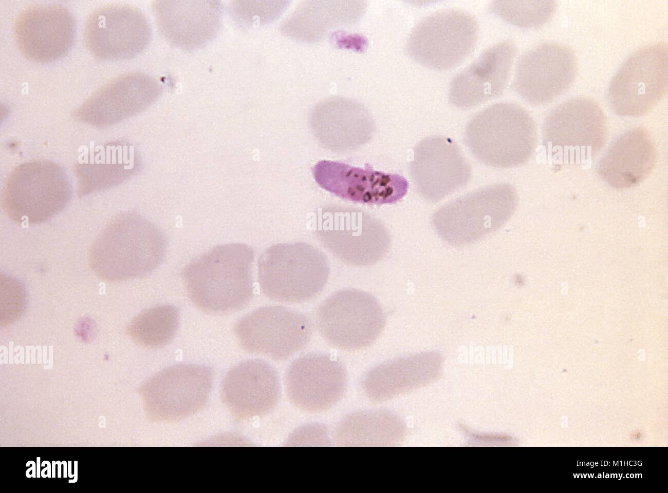 Plasmodium Falciparum Under Microscope