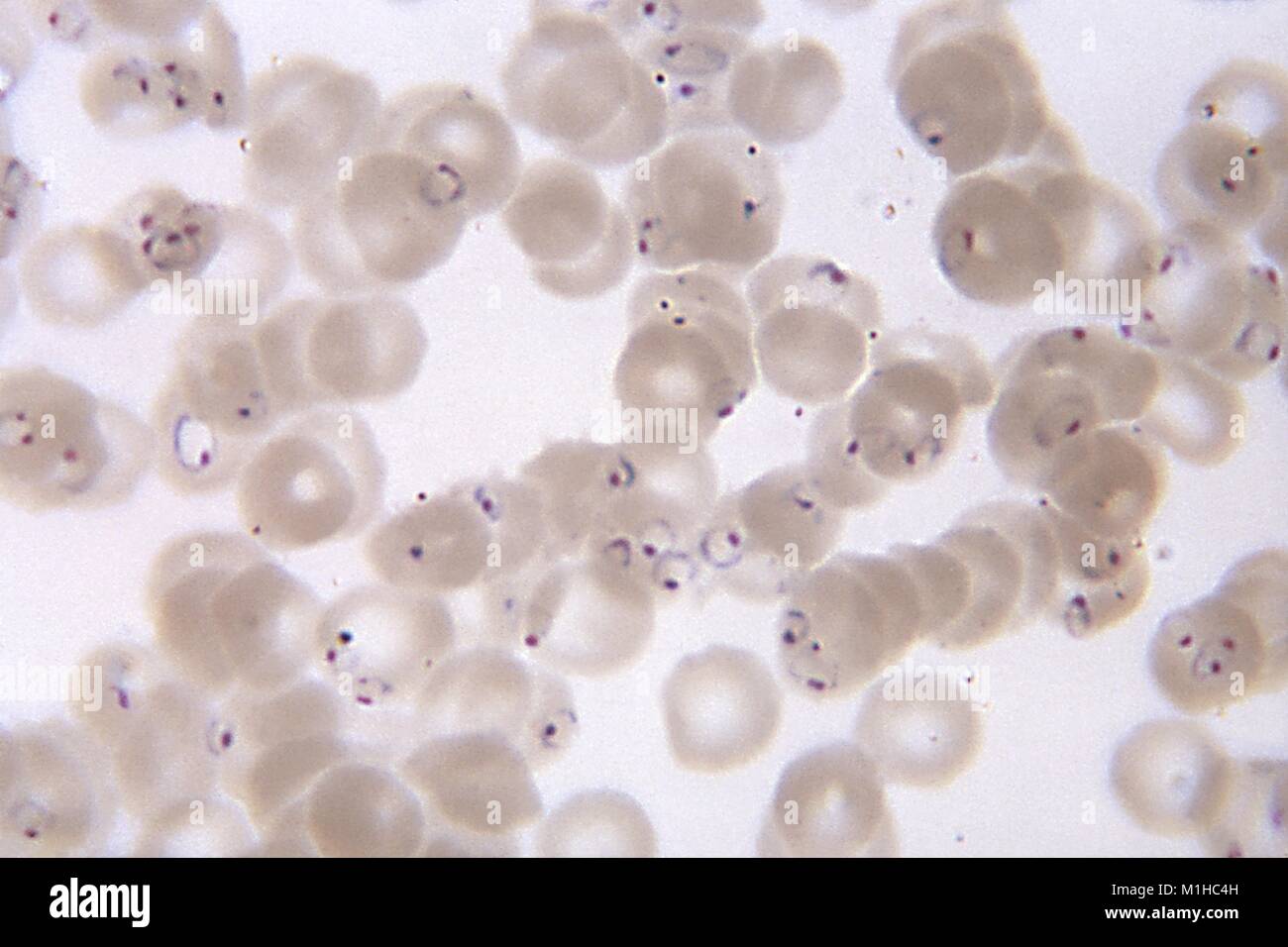 Human blood smear light micrograph hi-res stock photography and images ...