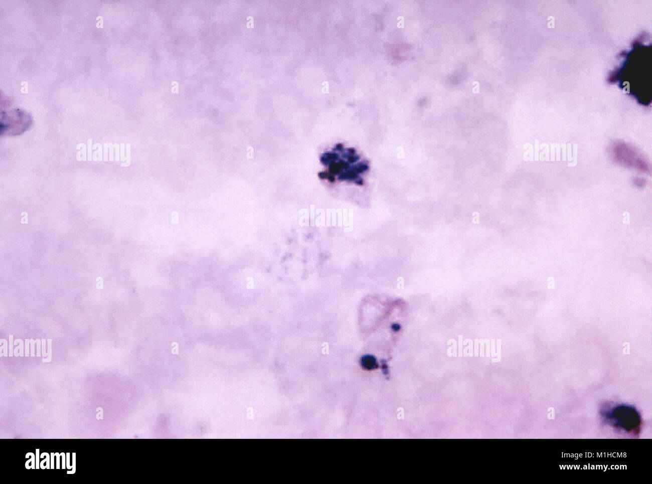 Plasmodium vivax schizont revealed on a thick micrograph film, 1964 ...