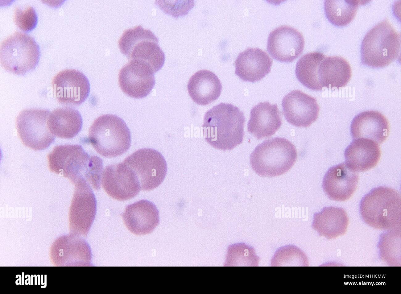 Human blood smear light micrograph hi-res stock photography and images ...