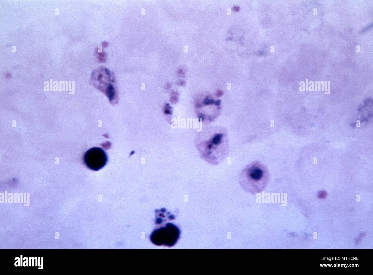 Photomicrograph of the malaria causing parasite Plasmodium vivax in its ...