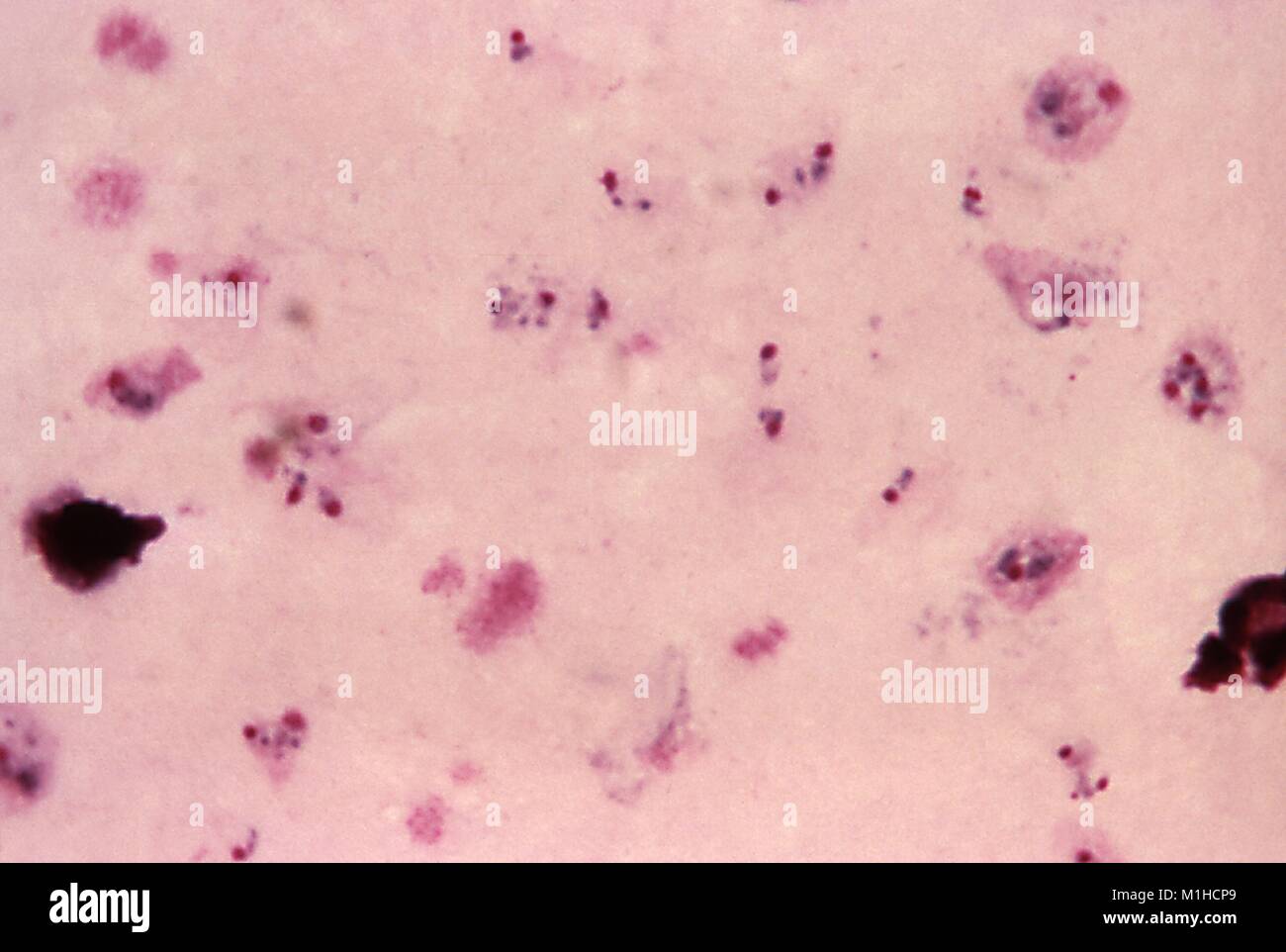 Photomicrograph of the malaria causing parasite Plasmodium vivax, in ...