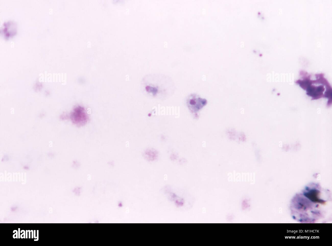 Photomicrograph of the malaria causing parasite Plasmodium vivax in its ...