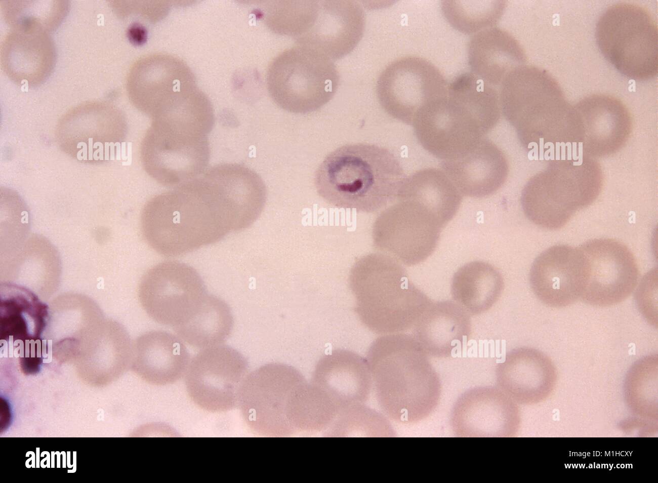 Plasmodium Ovale Trophozoite