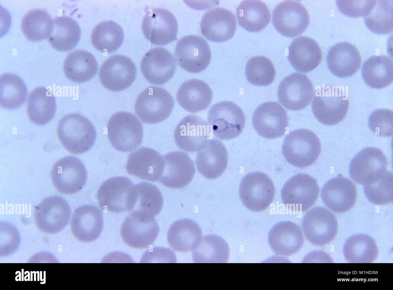 Photomicrograph of the malaria parasite Plasmodium vivax in 'tennis ...