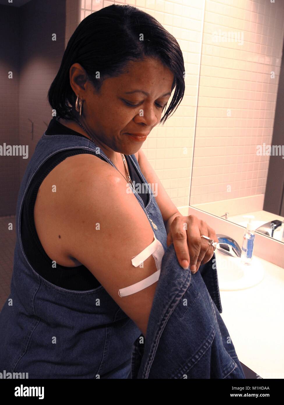 A woman covering gauze bandaged smallpox vaccination site with a jacket ...
